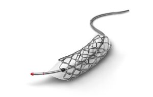 Balloon Catheters - Confluent Medical